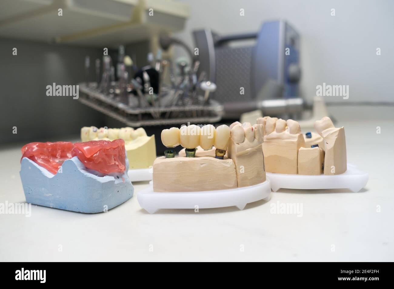 zirconia dental crowns on dental models in the dental laboratory Stock ...