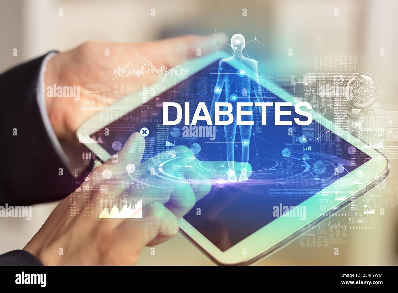 Electronic medical record with DIABETES inscription, Medical technology ...