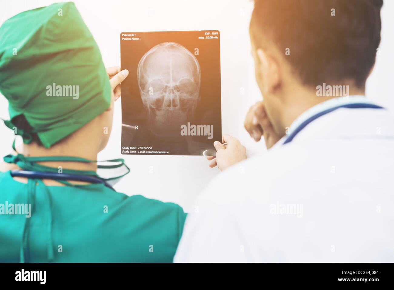 Brain skull hi-res stock photography and images - Alamy