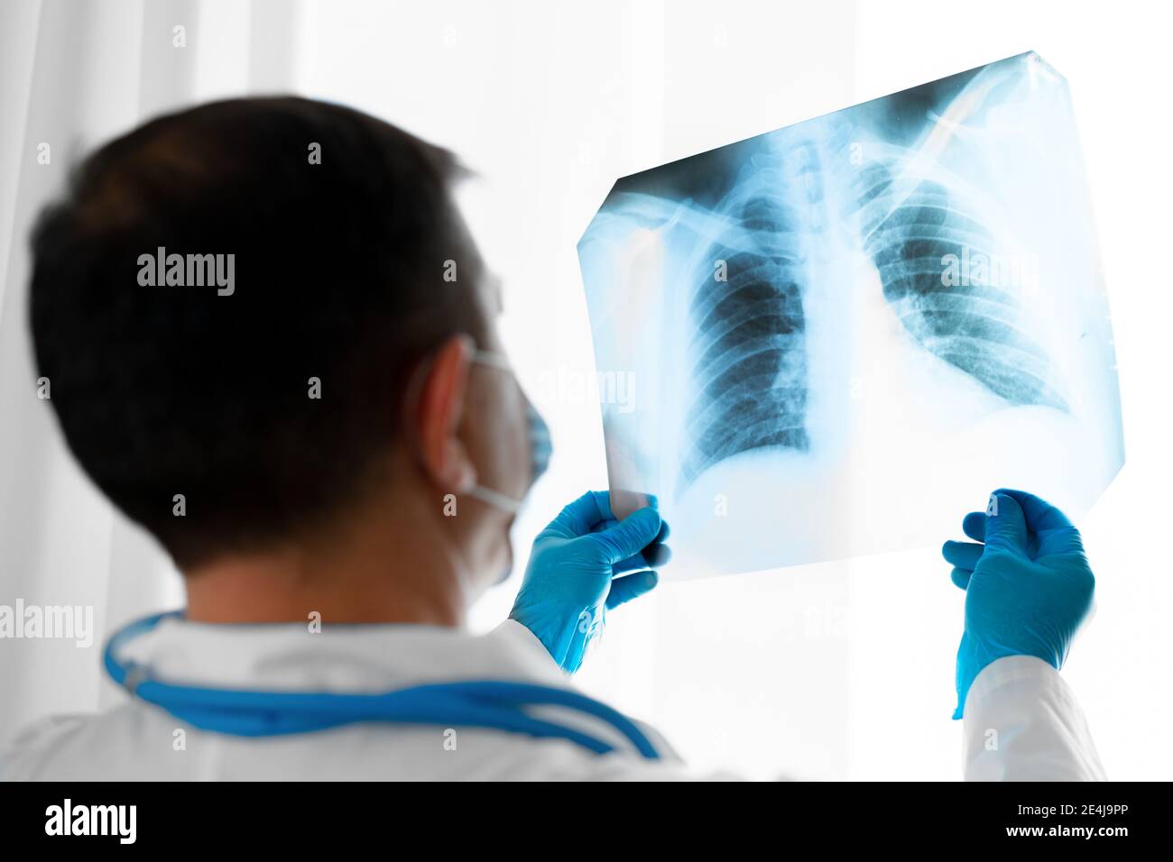 Doctor examining lungs x-ray scan in his office in hospital Stock Photo ...