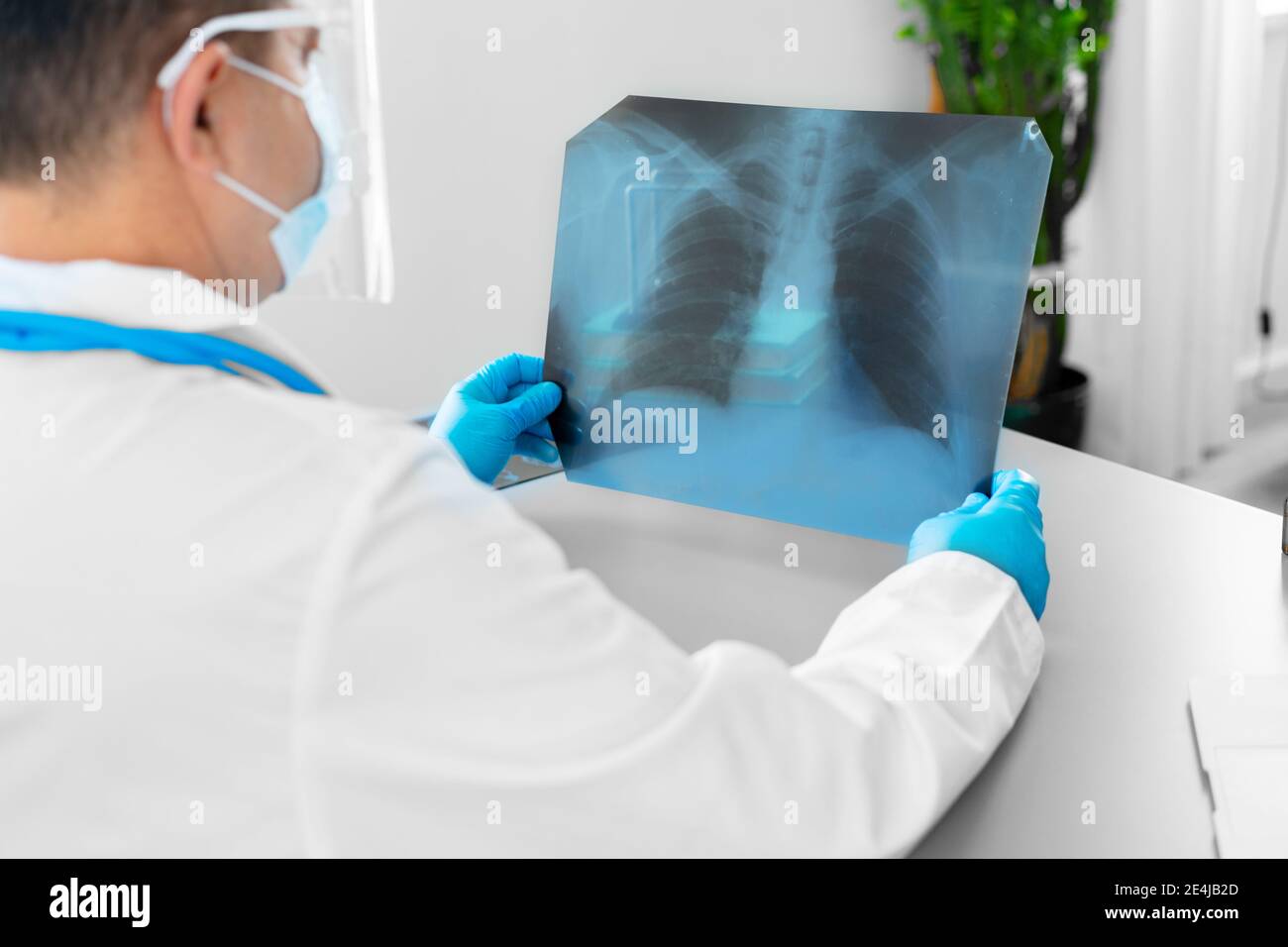 Doctor examining lungs x-ray scan in his office in hospital Stock Photo ...