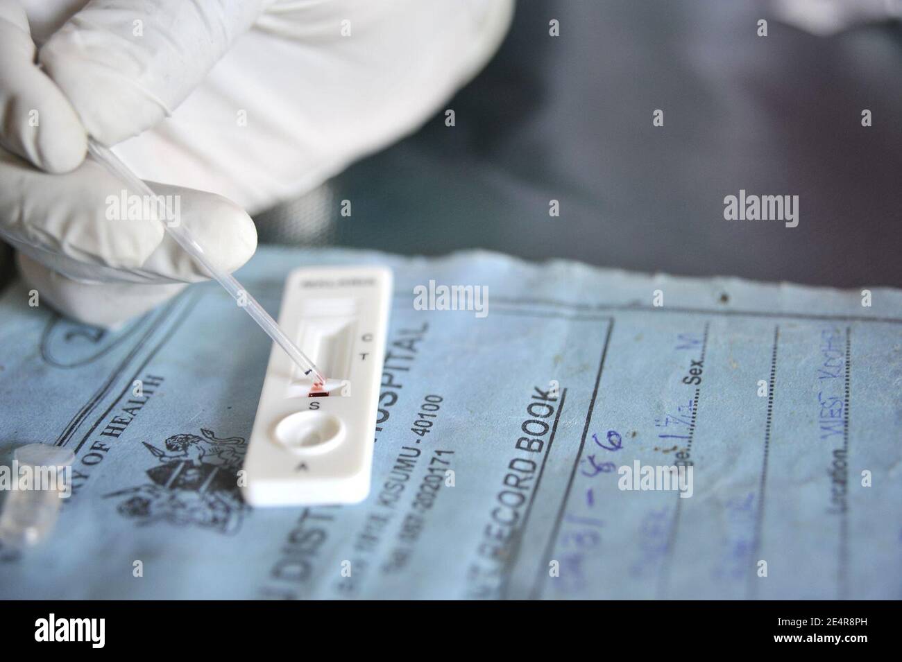 Malaria rapid diagnostic test 3 Stock Photo - Alamy