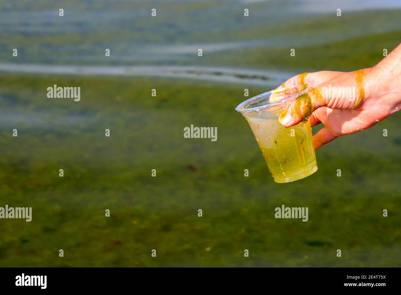 Global pollution of environment. A man collects dirty green water with ...