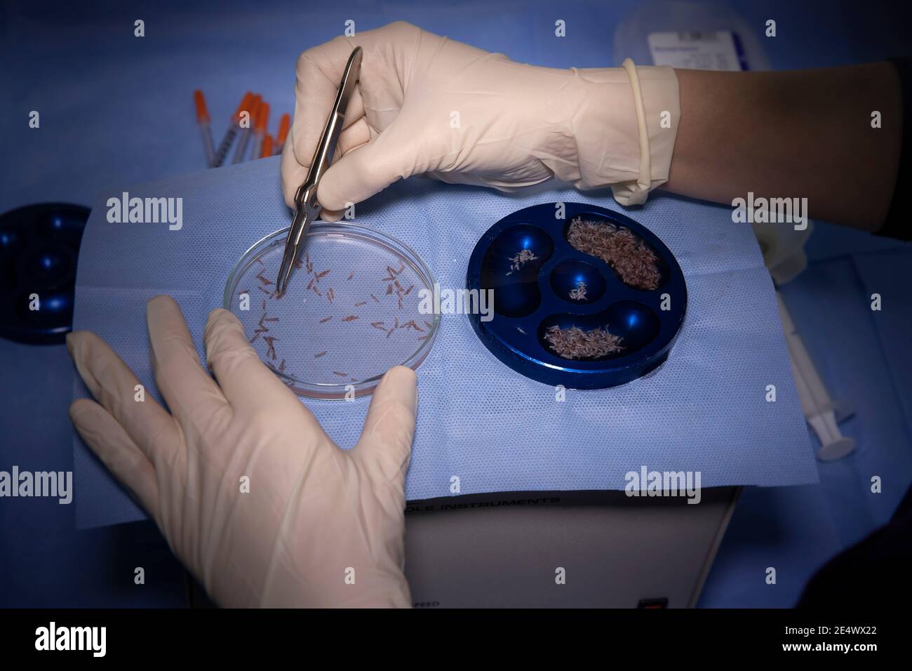 Hair Implant Process, Collecting Hair Plasma for Implanting Process ...