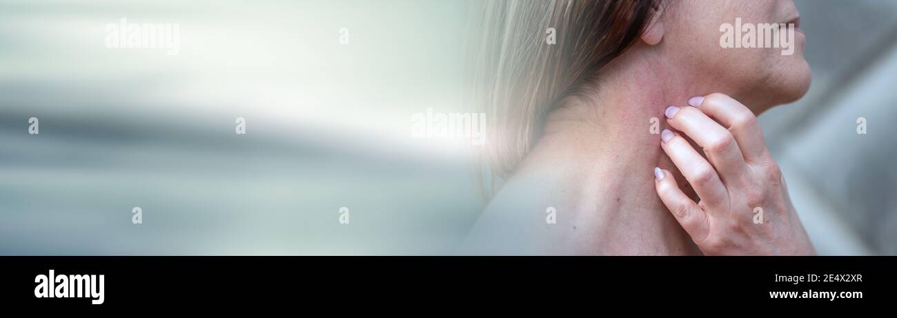 Woman having itchy and scratching her neck; panoramic banner Stock Photo - Alamy