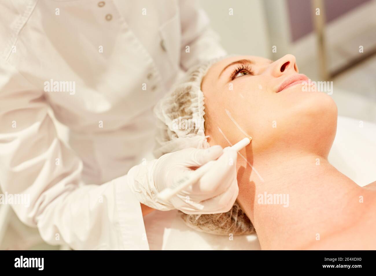 Preparation for plastic surgery on a woman's face by marking with pen ...