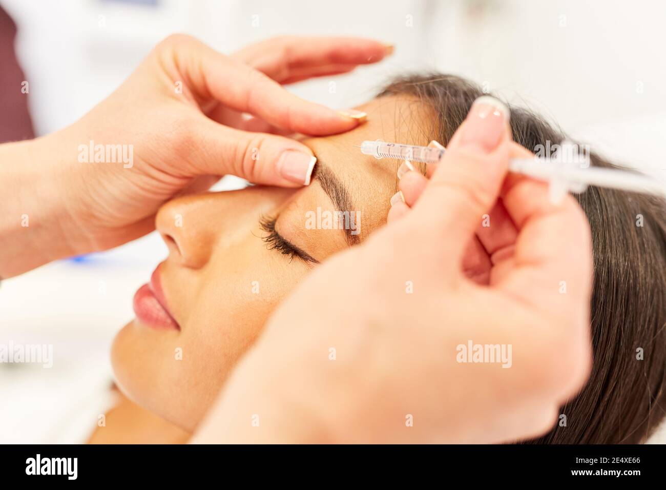 Woman spraying forehead wrinkles with hyaluronic acid as a wrinkle ...