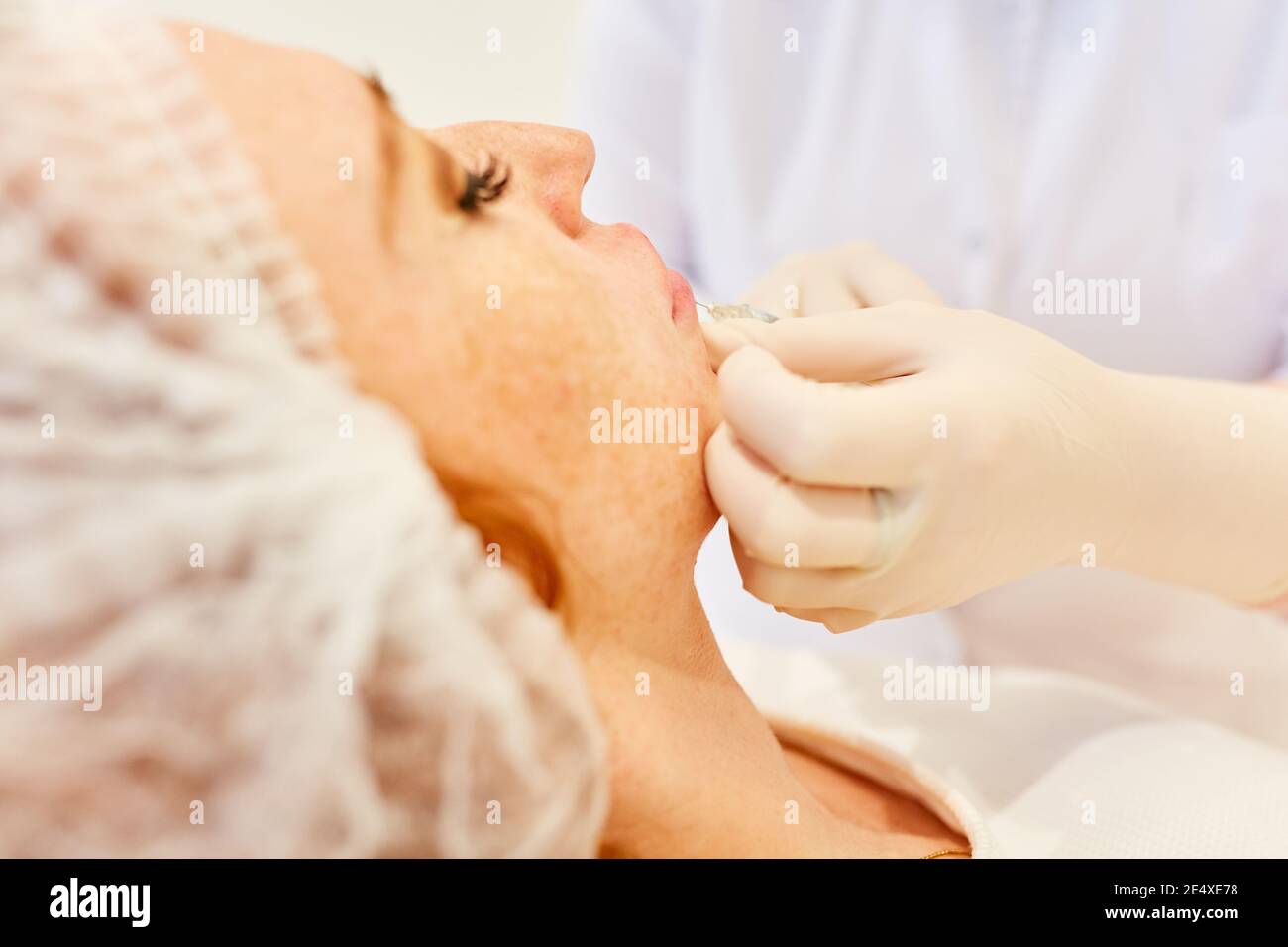Woman applying hyaluronic acid as a dermal filler while injecting lips ...