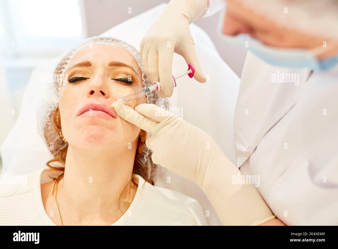 Woman gets an injection with hyaluronic acid as a dermal filler for lip ...