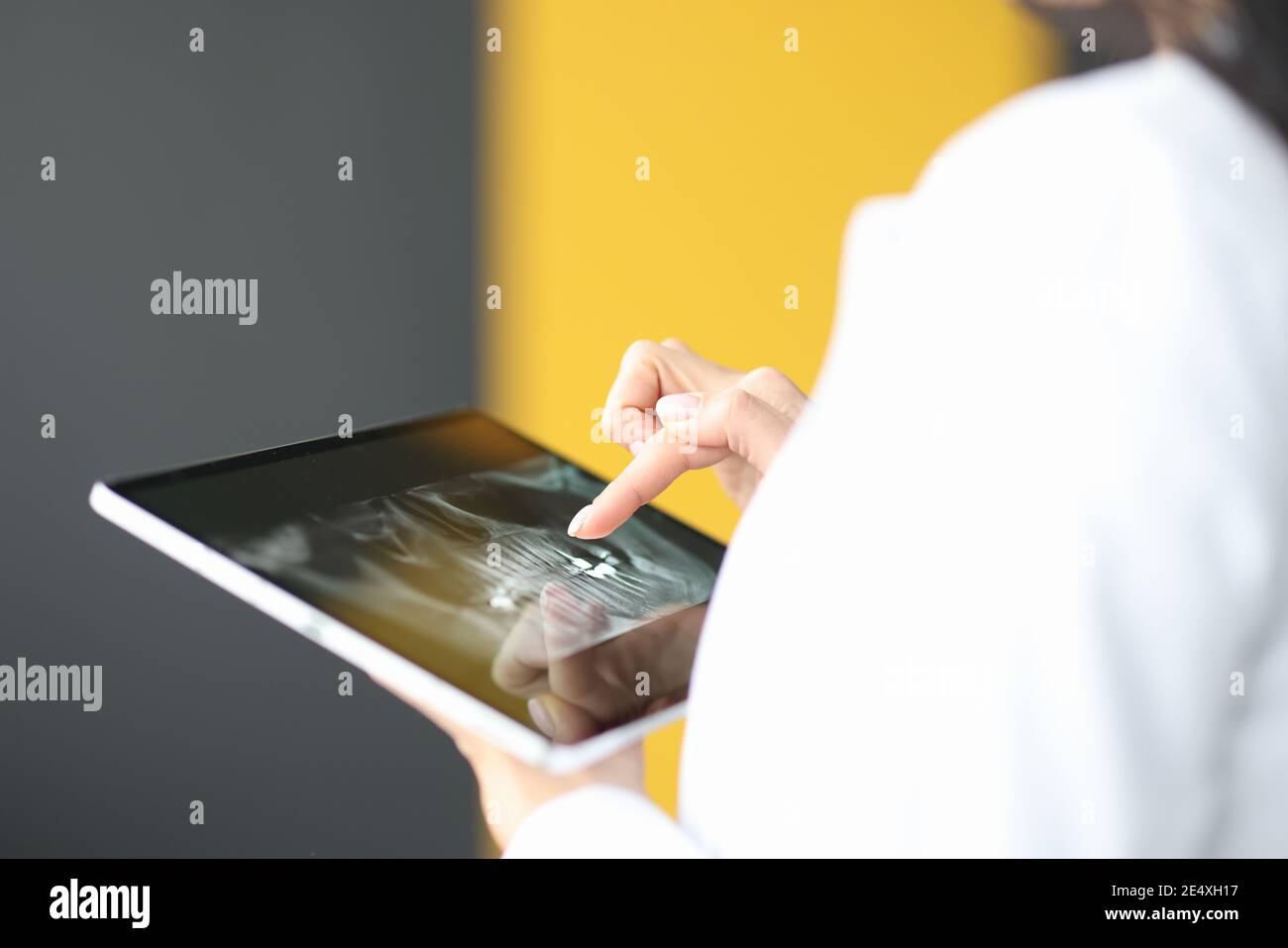 Female dentist showing x ray to patient at medical clinic hi-res stock ...