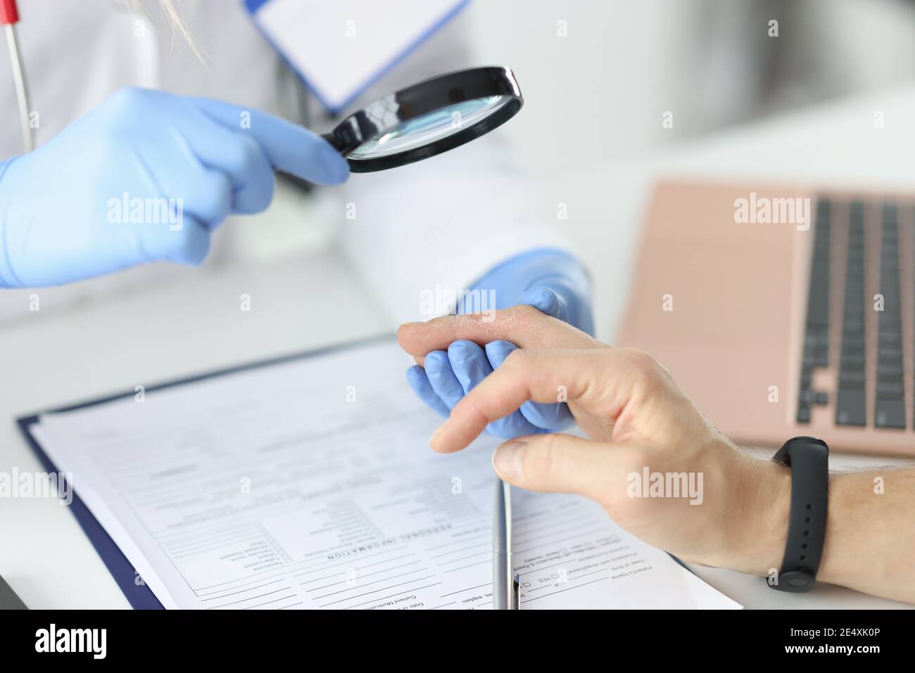 Doctor examines patient's peeling finger through magnifying glass Stock ...