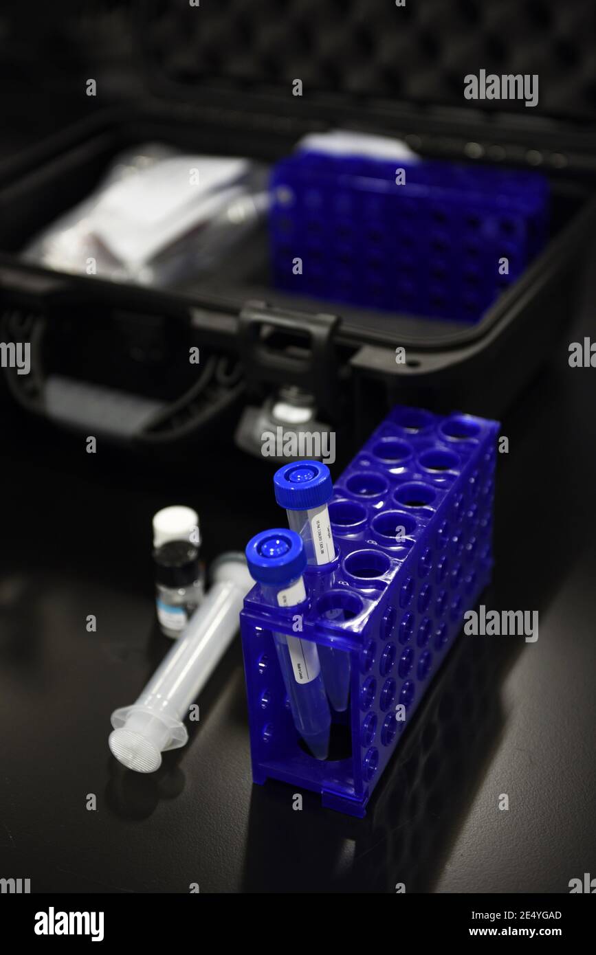 Selective focus of some plastic sample vials with blue lids. In a blue ...