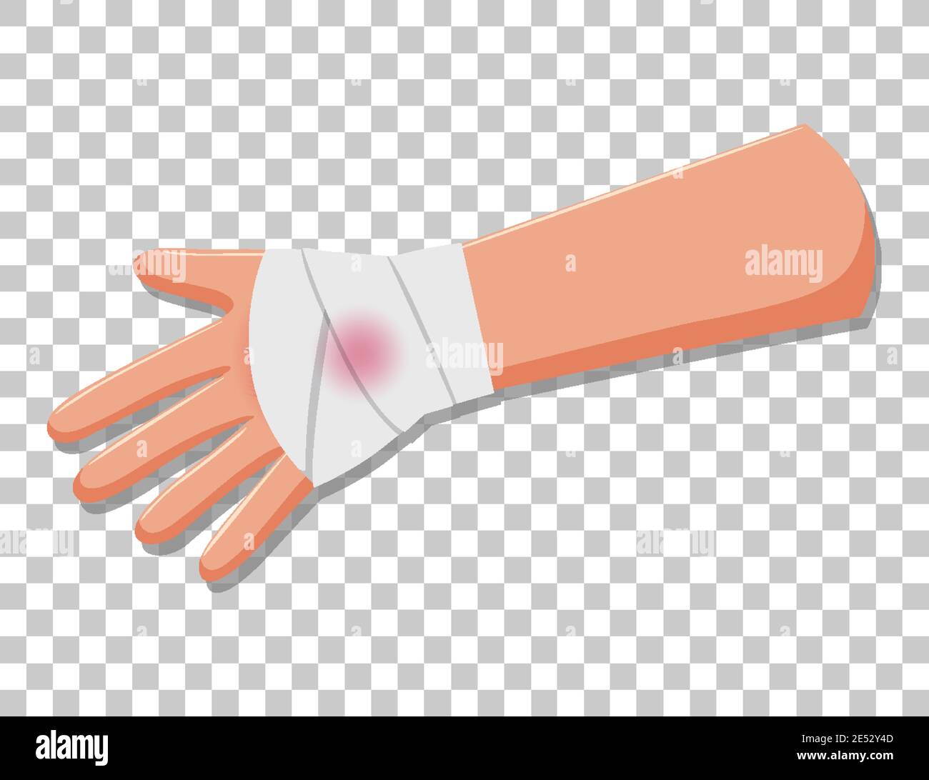 Injury arms with gauze on transparent background illustration Stock ...