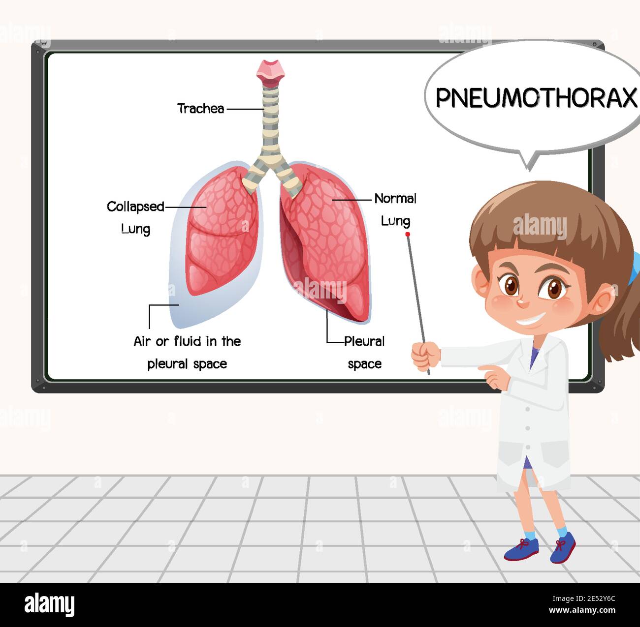Young scientist explain pneumothorax in front of a board in laboratory ...