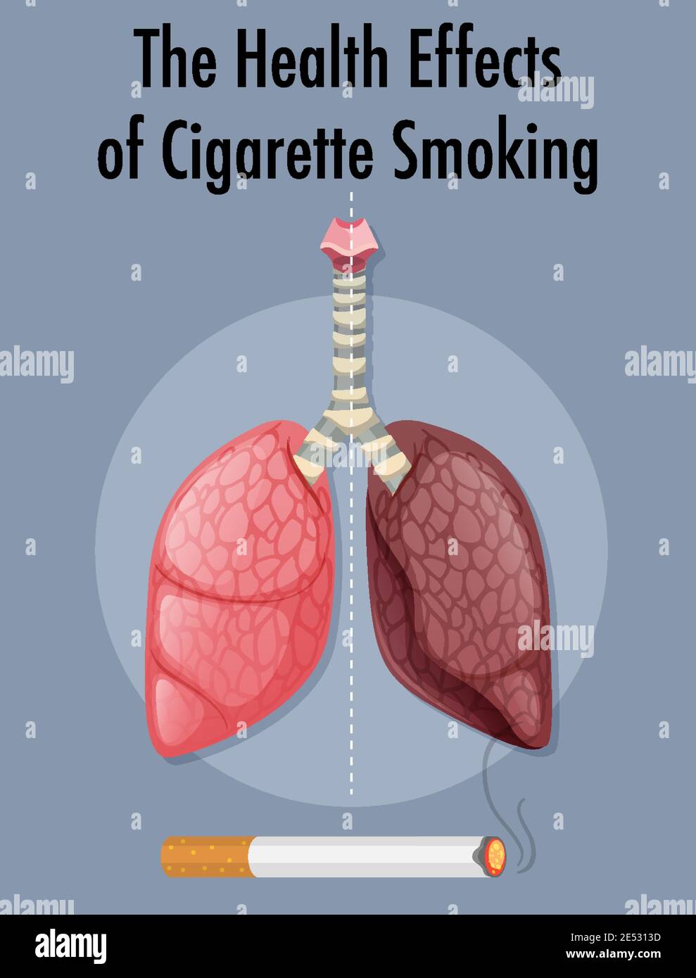 Poster on health effects of cigarette smoking illustration Stock Vector ...