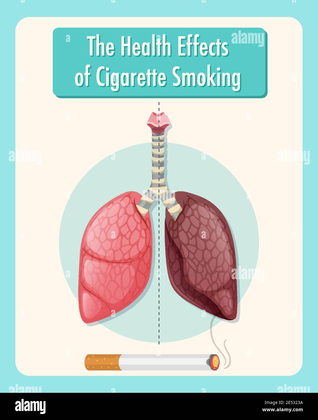 Poster on health effects of cigarette smoking illustration Stock Vector ...