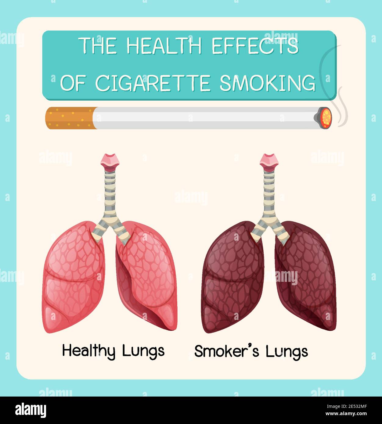 Poster on health effects of cigarette smoking illustration Stock Vector ...