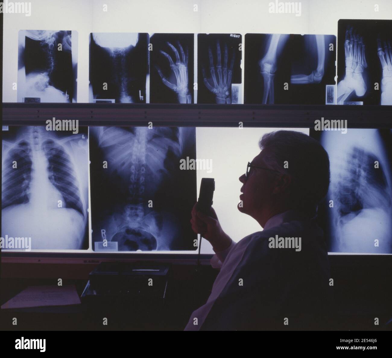 Chest xrays hi-res stock photography and images - Alamy