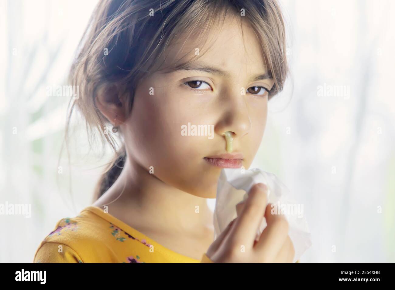 Snot in a child face close-up. Cold. Selective focus. People Stock ...