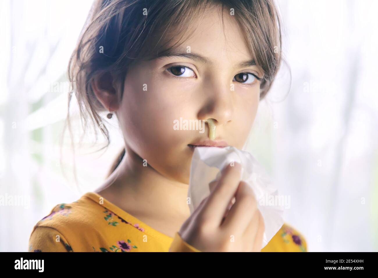 Snot in a child face close-up. Cold. Selective focus. People Stock ...