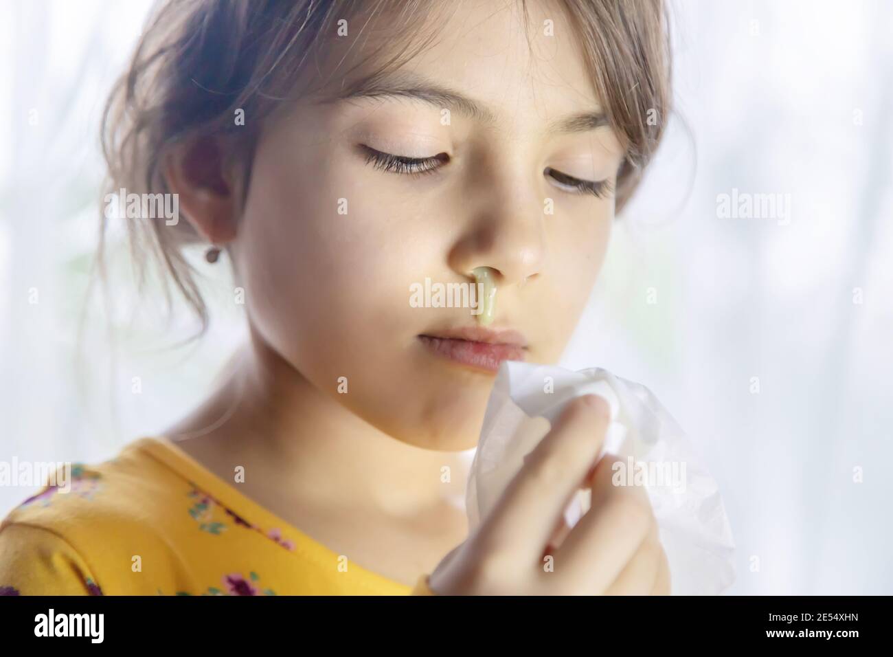 Snot in a child face close-up. Cold. Selective focus. People Stock ...