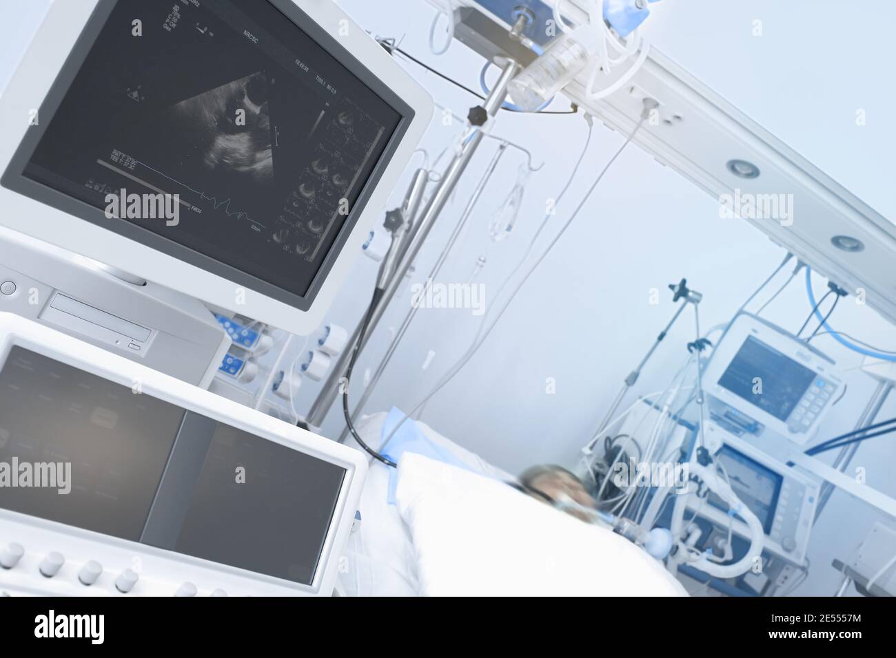 Hear monitoring of patient in the critical care unit Stock Photo - Alamy