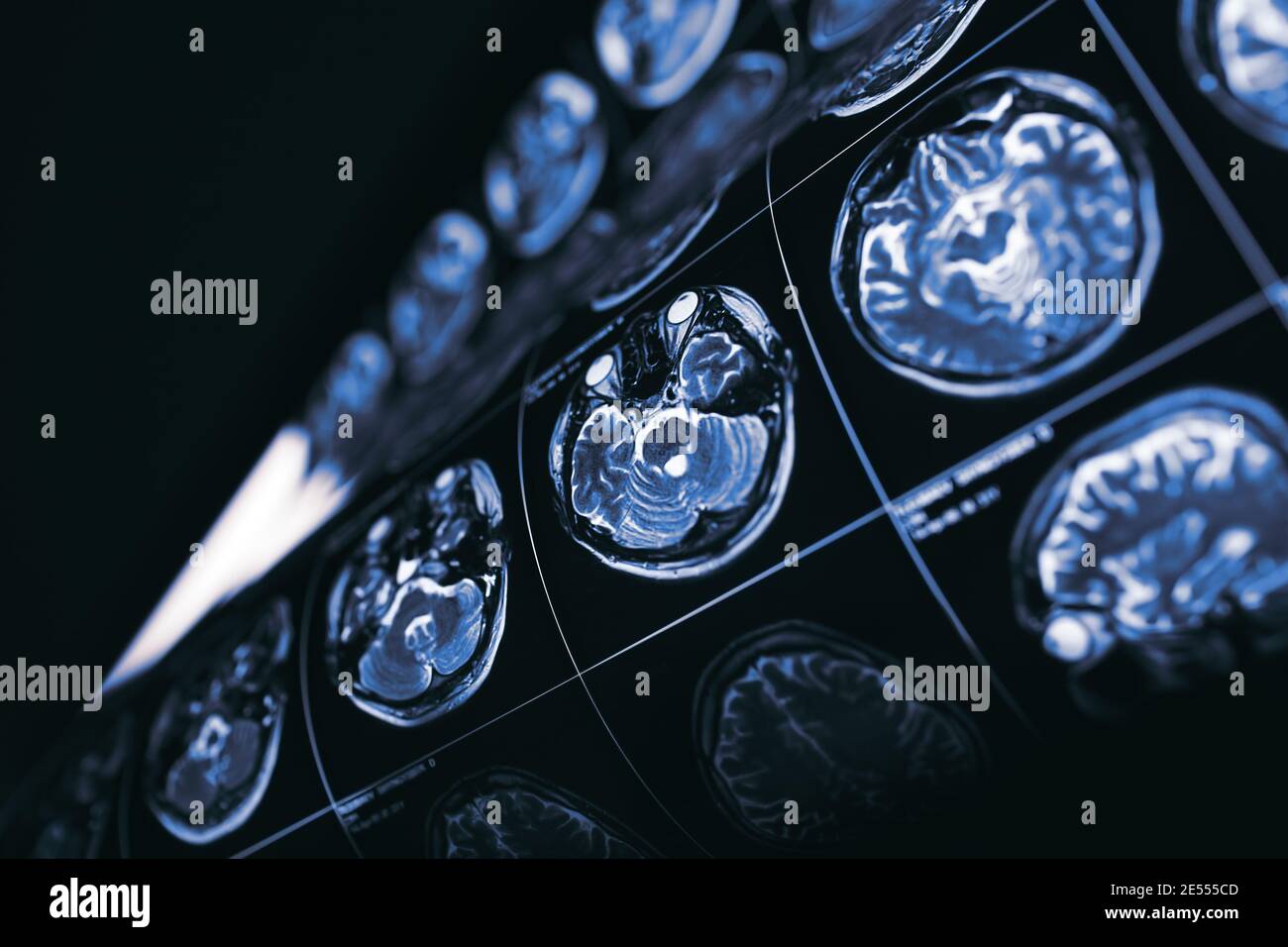Mri of healthy brain hi-res stock photography and images - Alamy