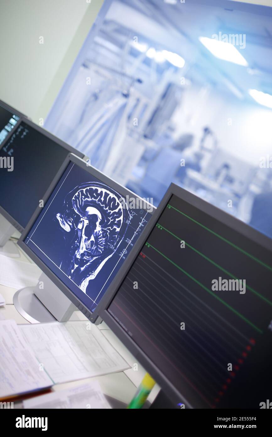 Human brain ray scan hi-res stock photography and images - Alamy
