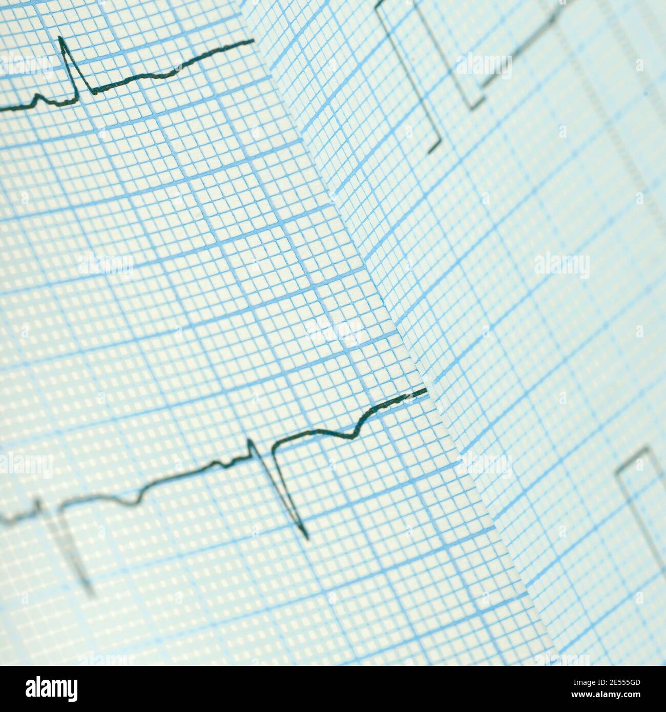 Bended ECG paper as a medical background Stock Photo - Alamy