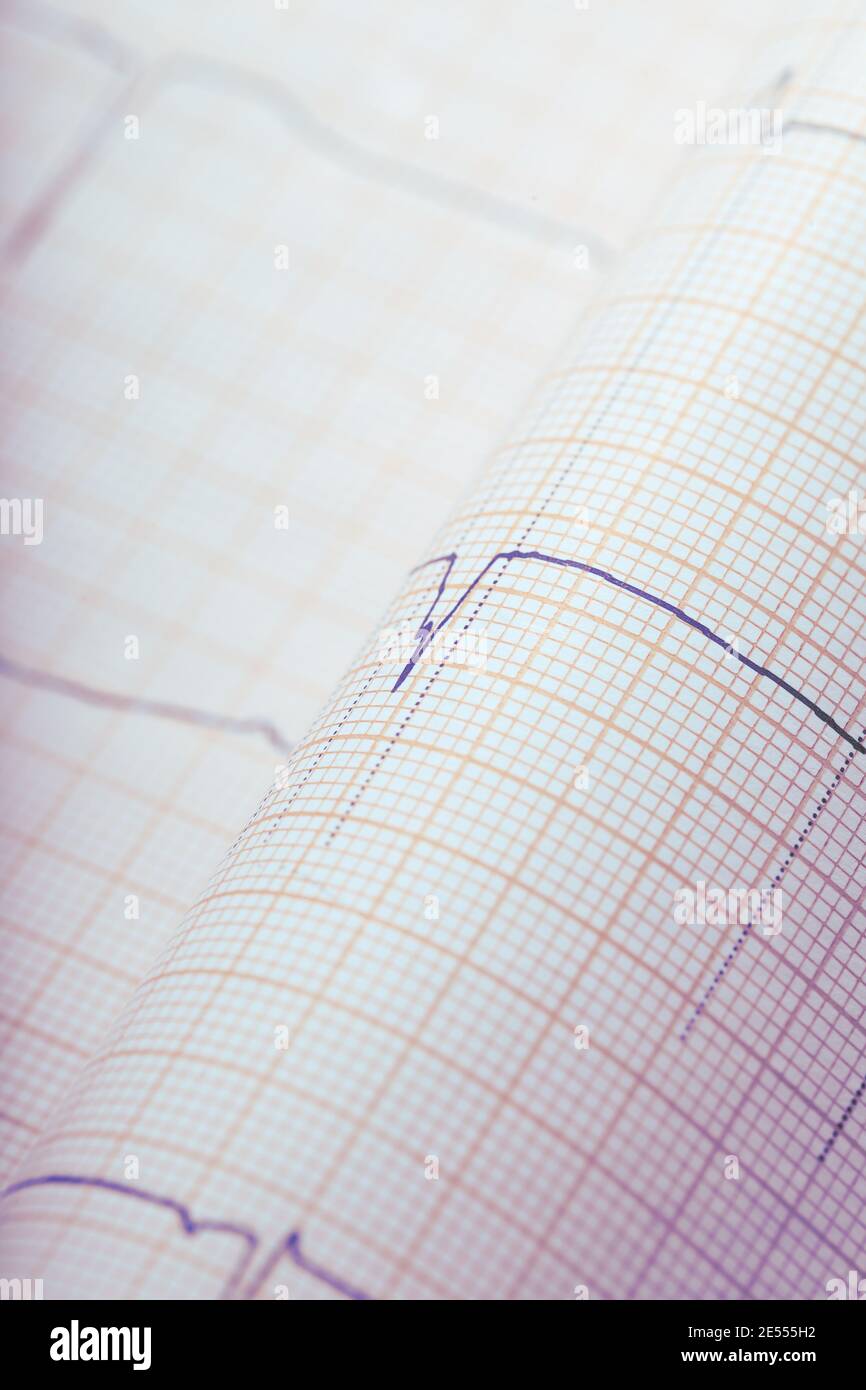 Ecg tracing hi-res stock photography and images - Alamy