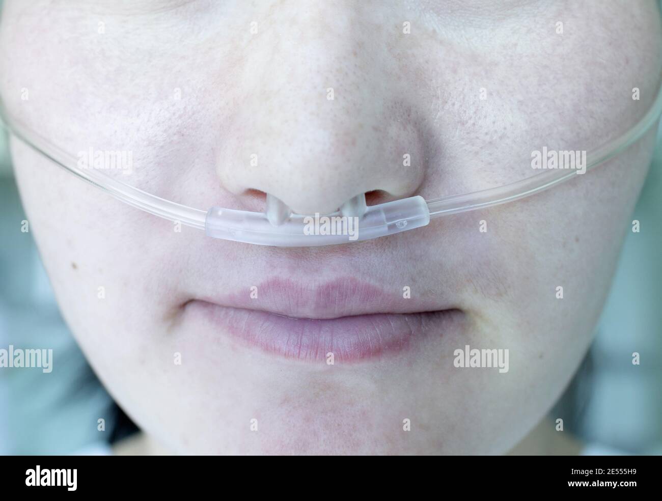 Oxygen deficiency hi-res stock photography and images - Alamy