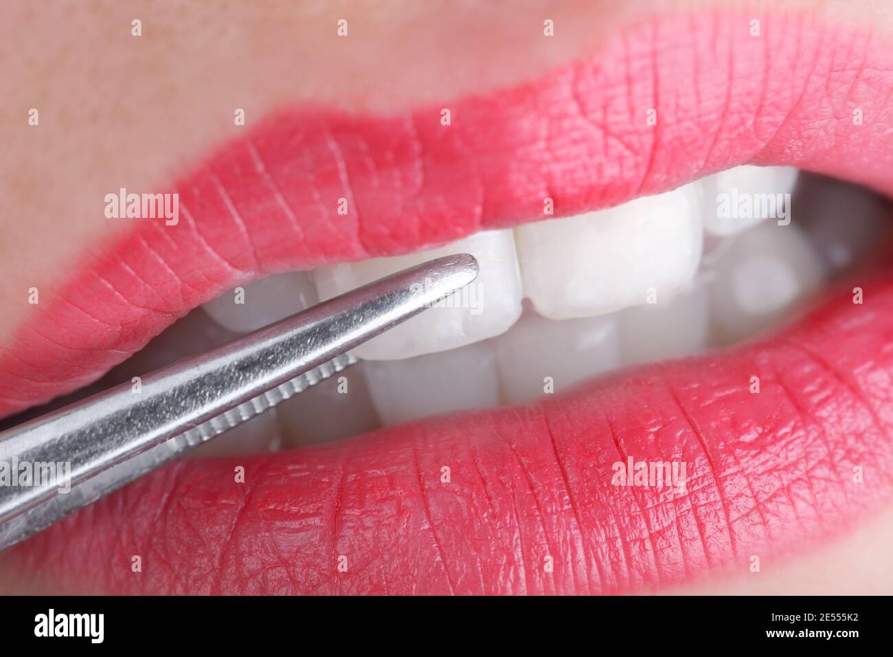 Dental inspection of female patient Stock Photo - Alamy