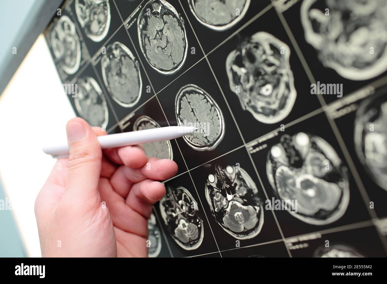 Ct mri hi-res stock photography and images - Alamy