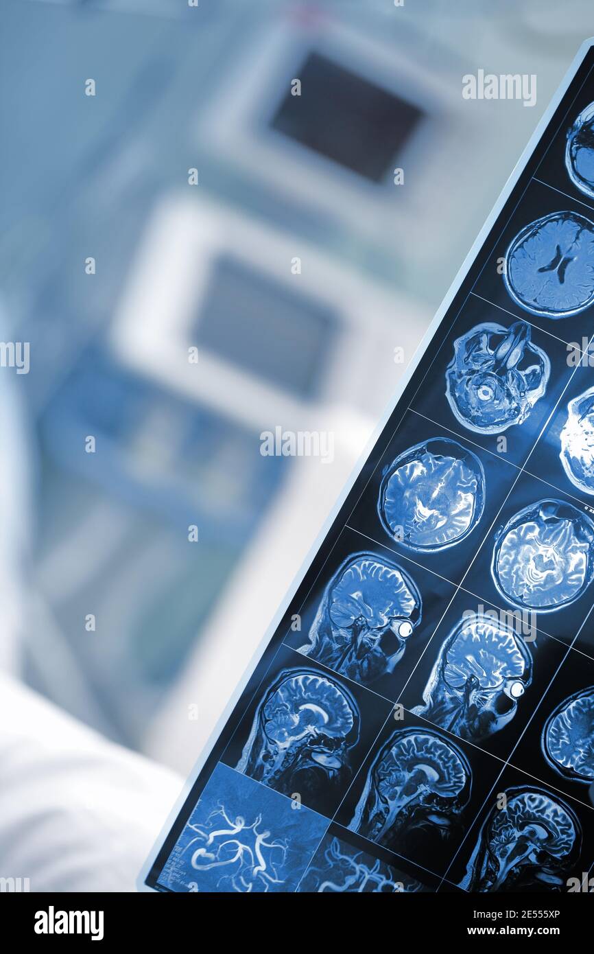 Hand ct scan hi-res stock photography and images - Alamy