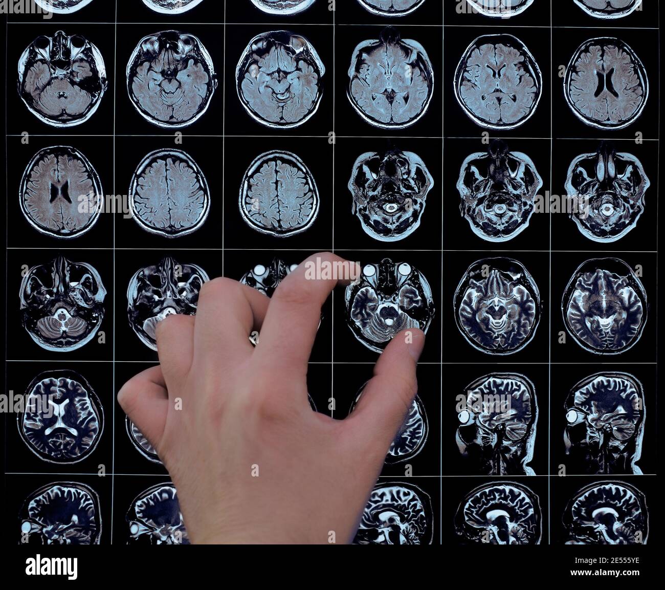 Doctor ct scan head hi-res stock photography and images - Alamy