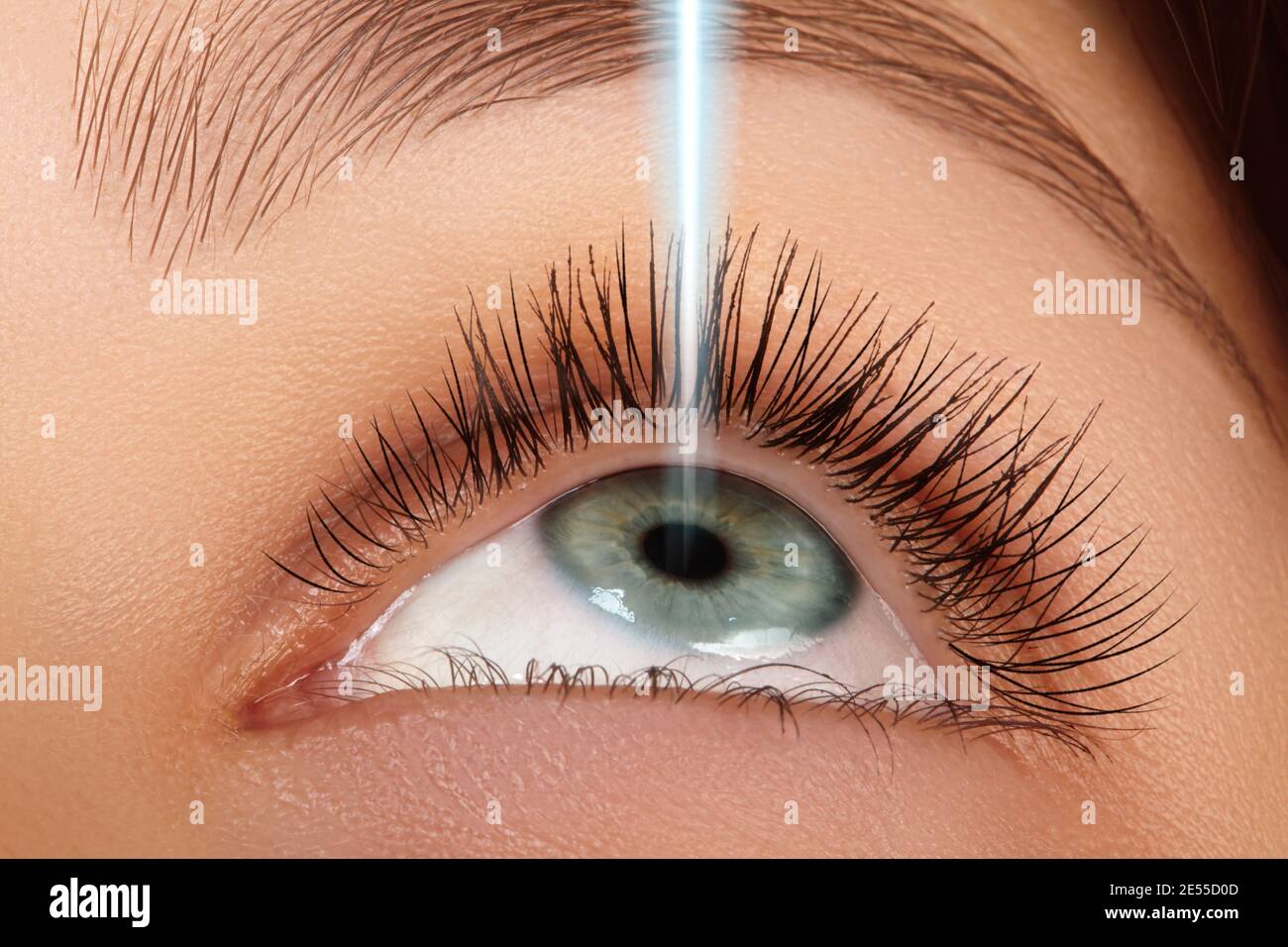 Laser surgery and correction on beauty female eye. Macro of young eyes ...