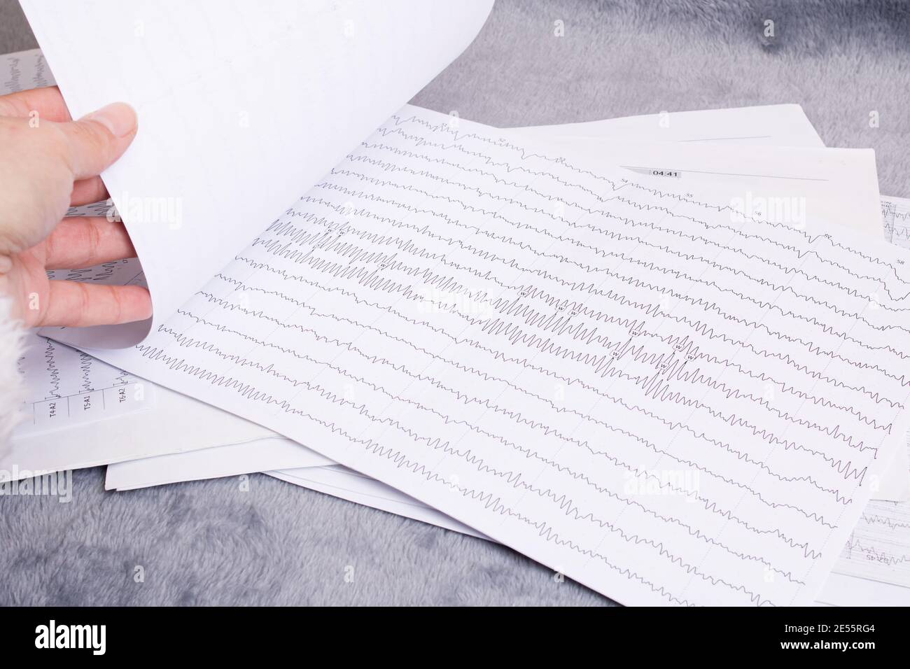 Eeg brain hi-res stock photography and images - Alamy