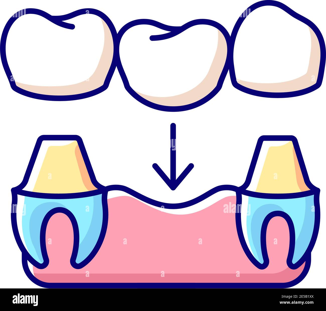 Dental prosthetics RGB color icon Stock Vector Image & Art - Alamy