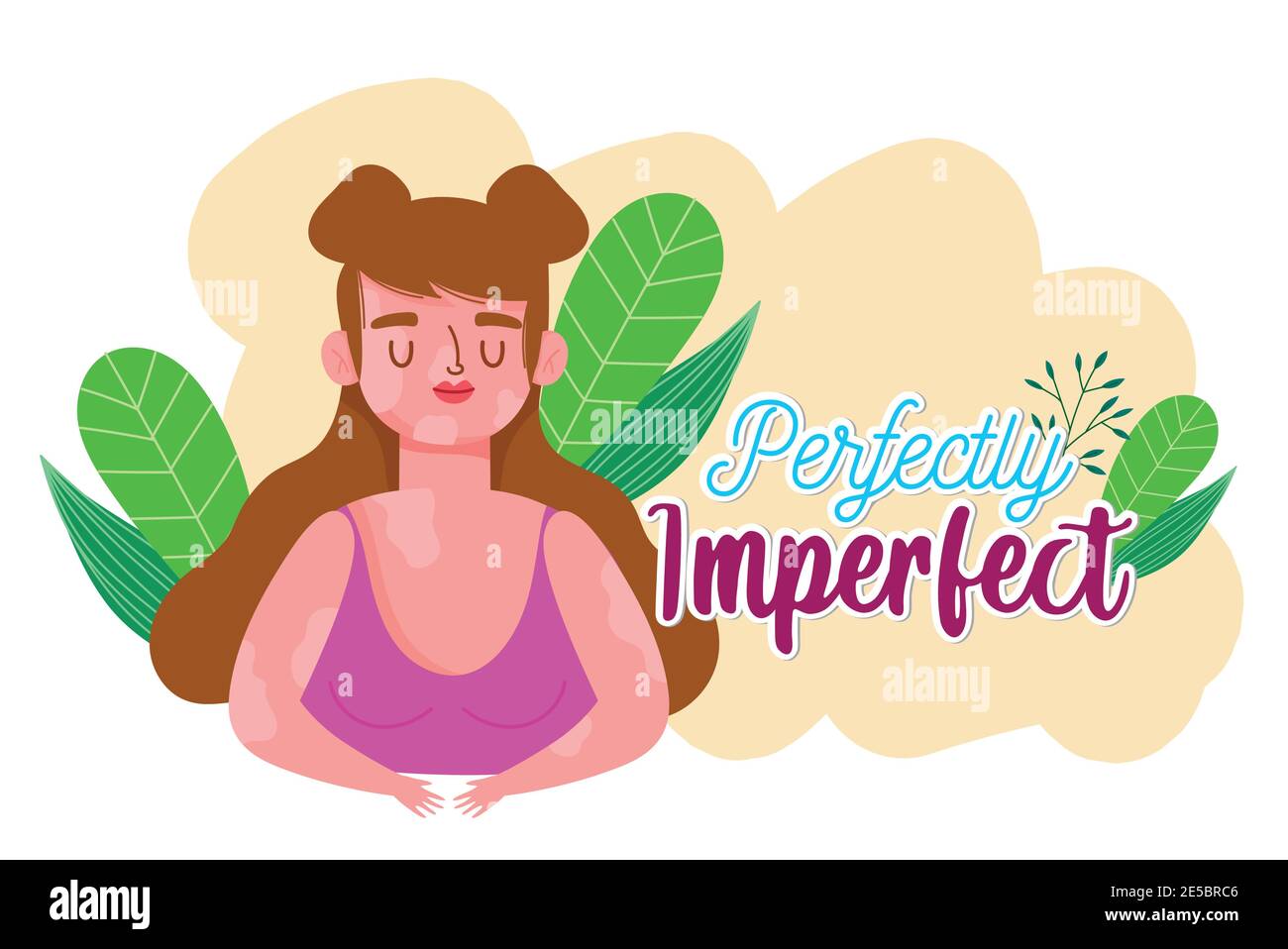 Perfectly imperfect, woman with vitiligo portrait vector illustration ...