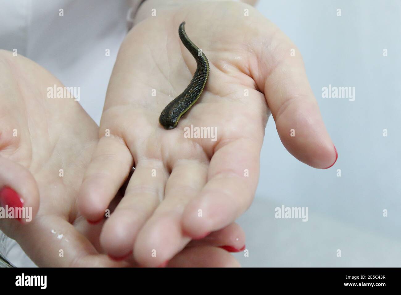 medical leech on the doctor's gloved hand Stock Photo - Alamy