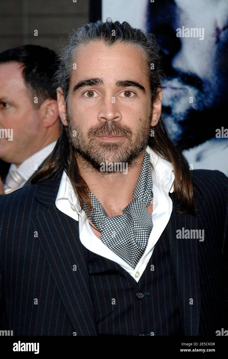 Colin Farrell Hair Transplant