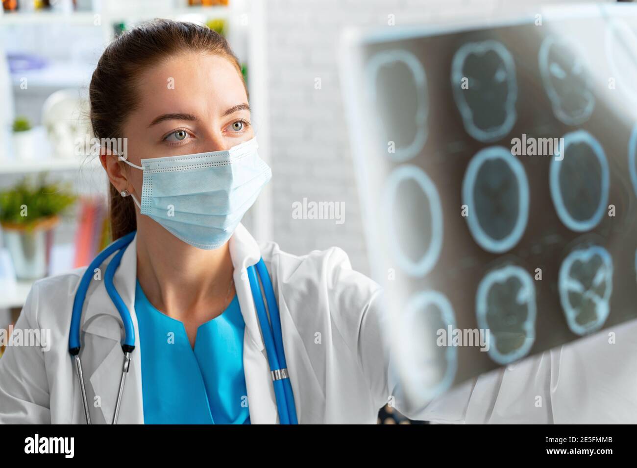 Woman doctor examines head mri scan in hospital Stock Photo - Alamy