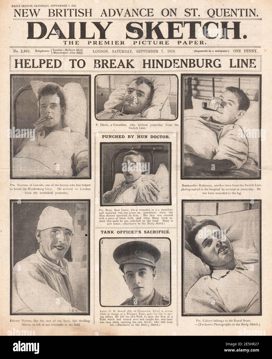 British hospital world war 1 hi-res stock photography and images - Alamy