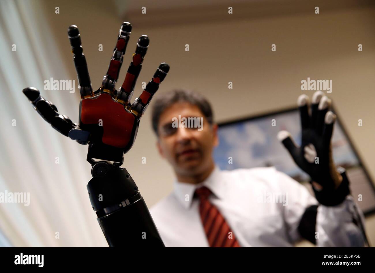Revolutionizing prosthetics program hi-res stock photography and images ... Revolutionizing prosthetics program hi-res stock photography and images ...