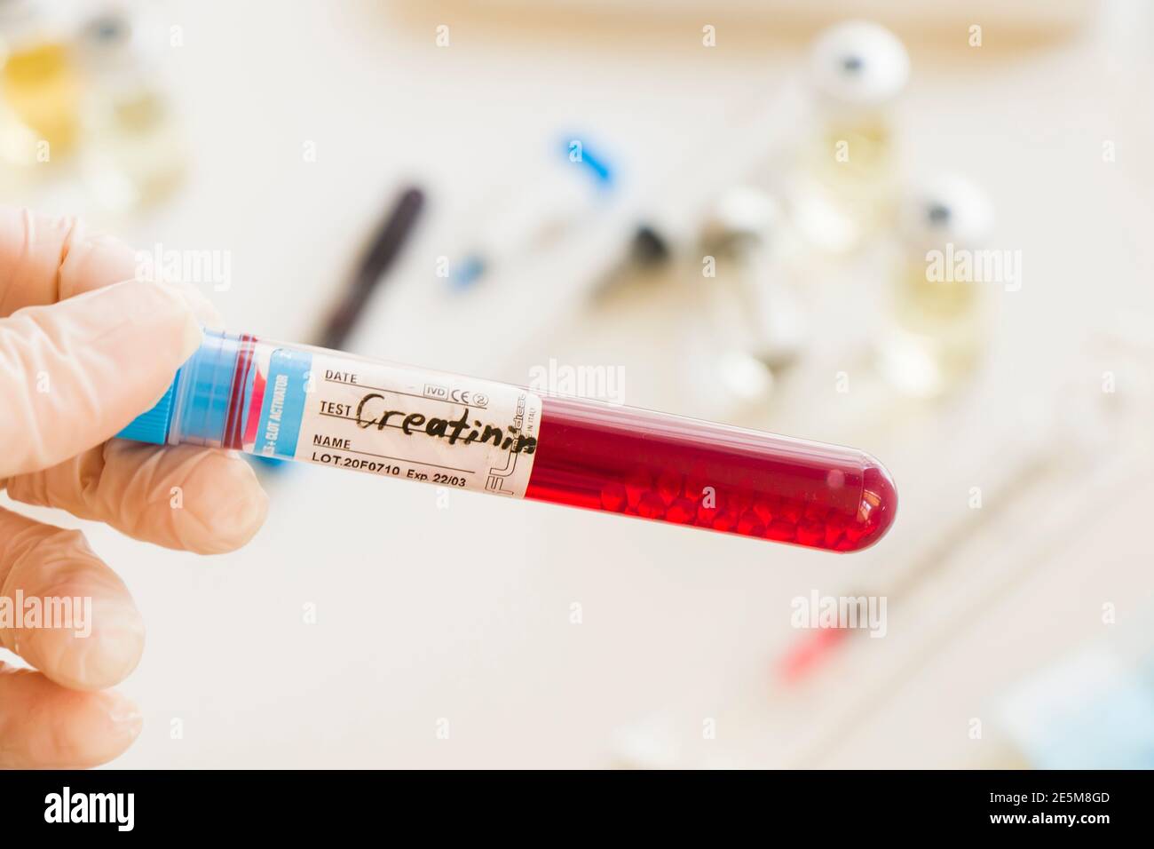 Tbilisi, Georgia - January 27, 2021: Creatinine blood test tube sample ...