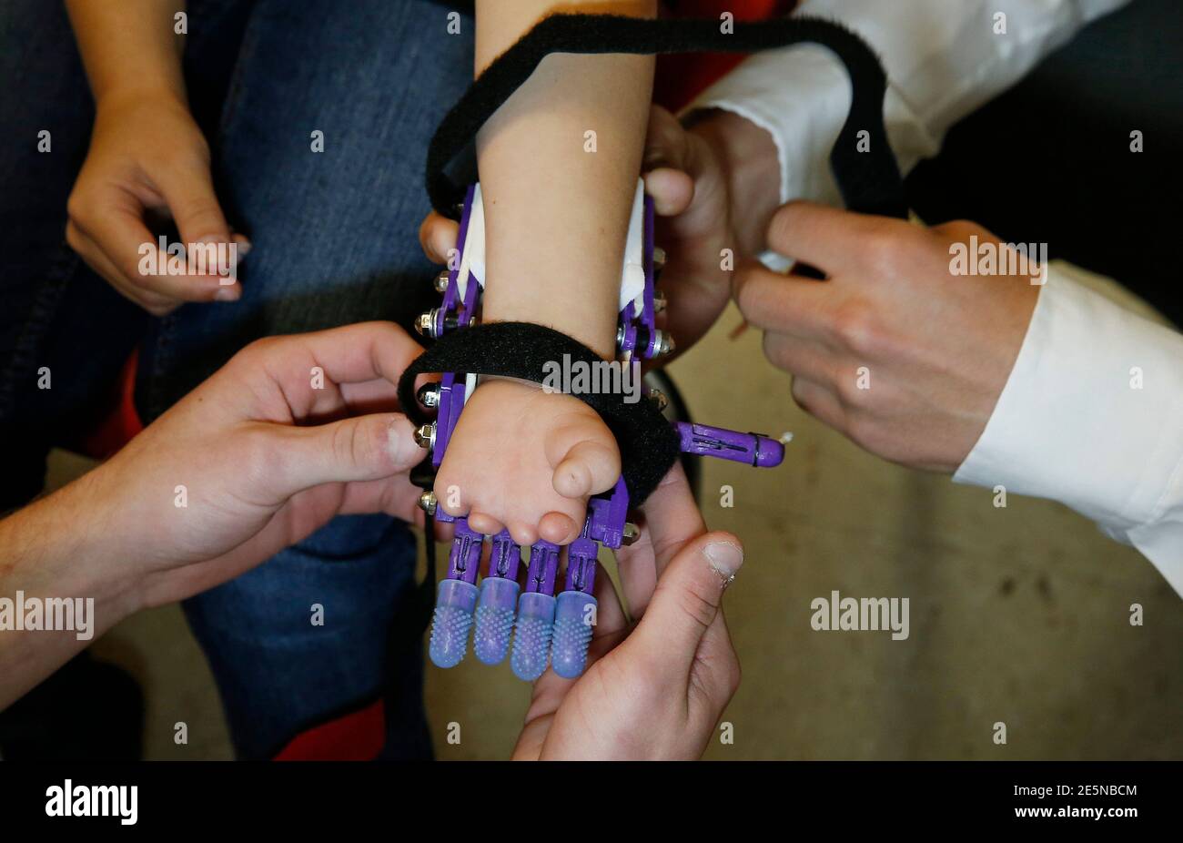 Prosthetic engineering hi-res stock photography and images - Alamy