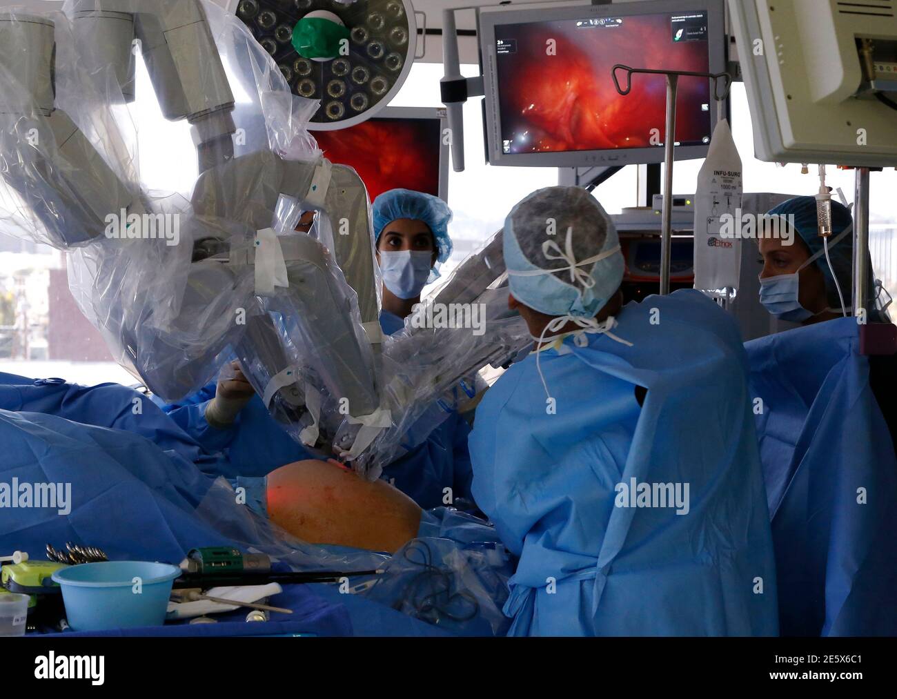 Fibroids High Resolution Stock Photography and Images - Alamy