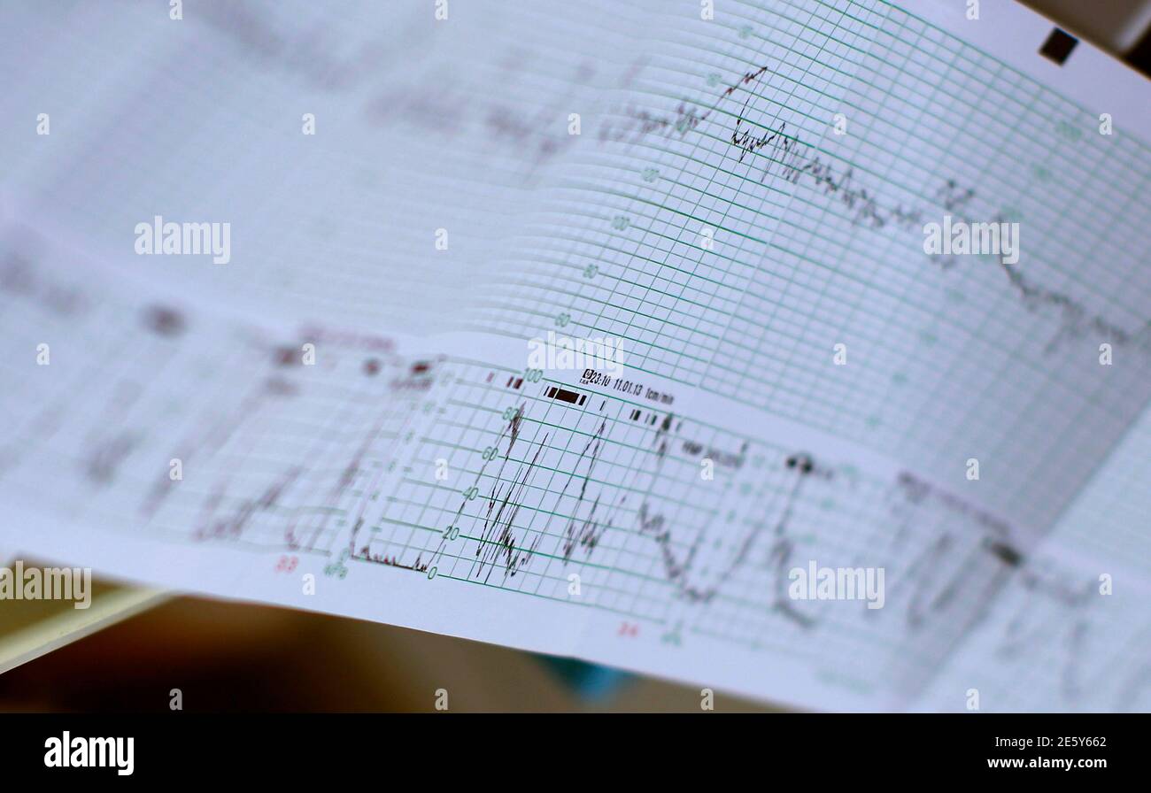 Cardiotocograph High Resolution Stock Photography and Images - Alamy
