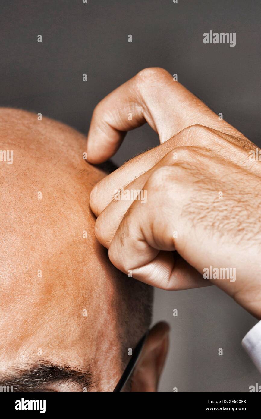 Office worker scratching head hi-res stock photography and images - Alamy