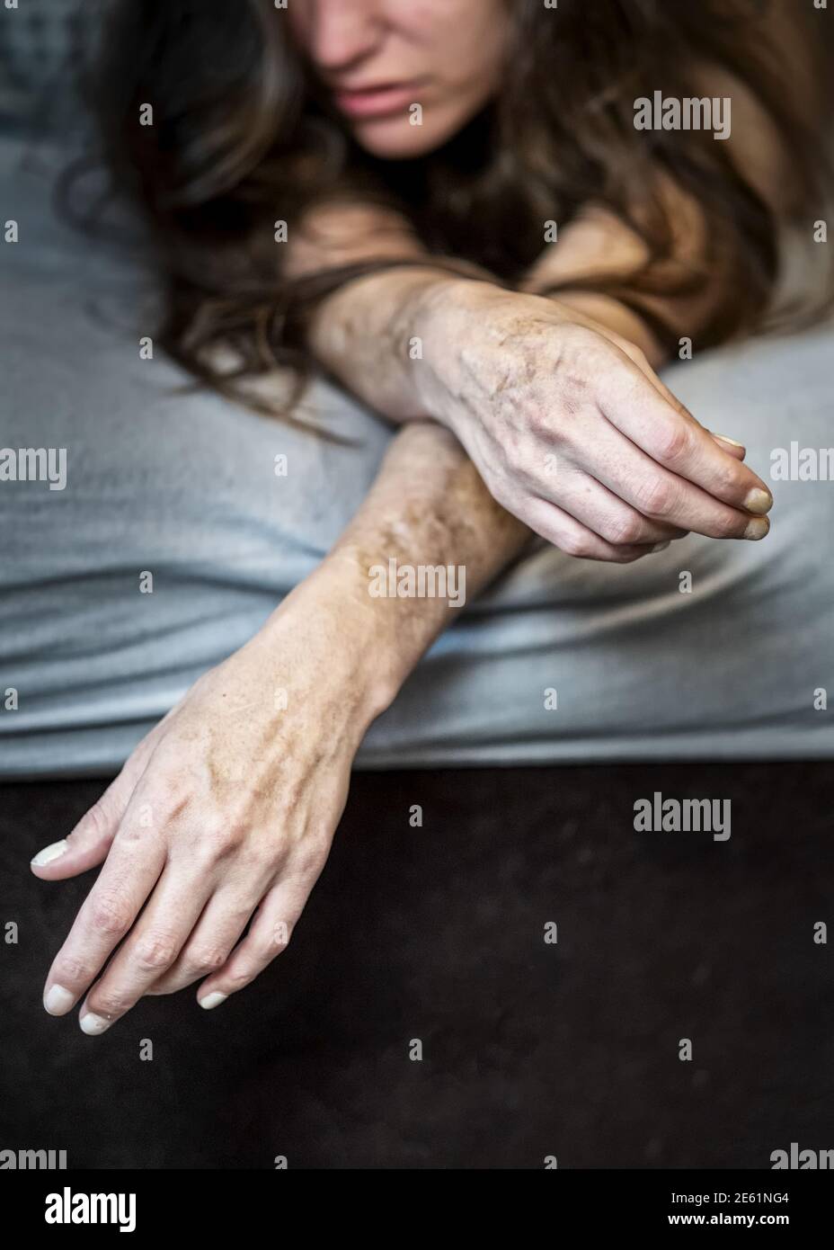 Self harm on frustrated disillusioned sick woman lying on bed with ...